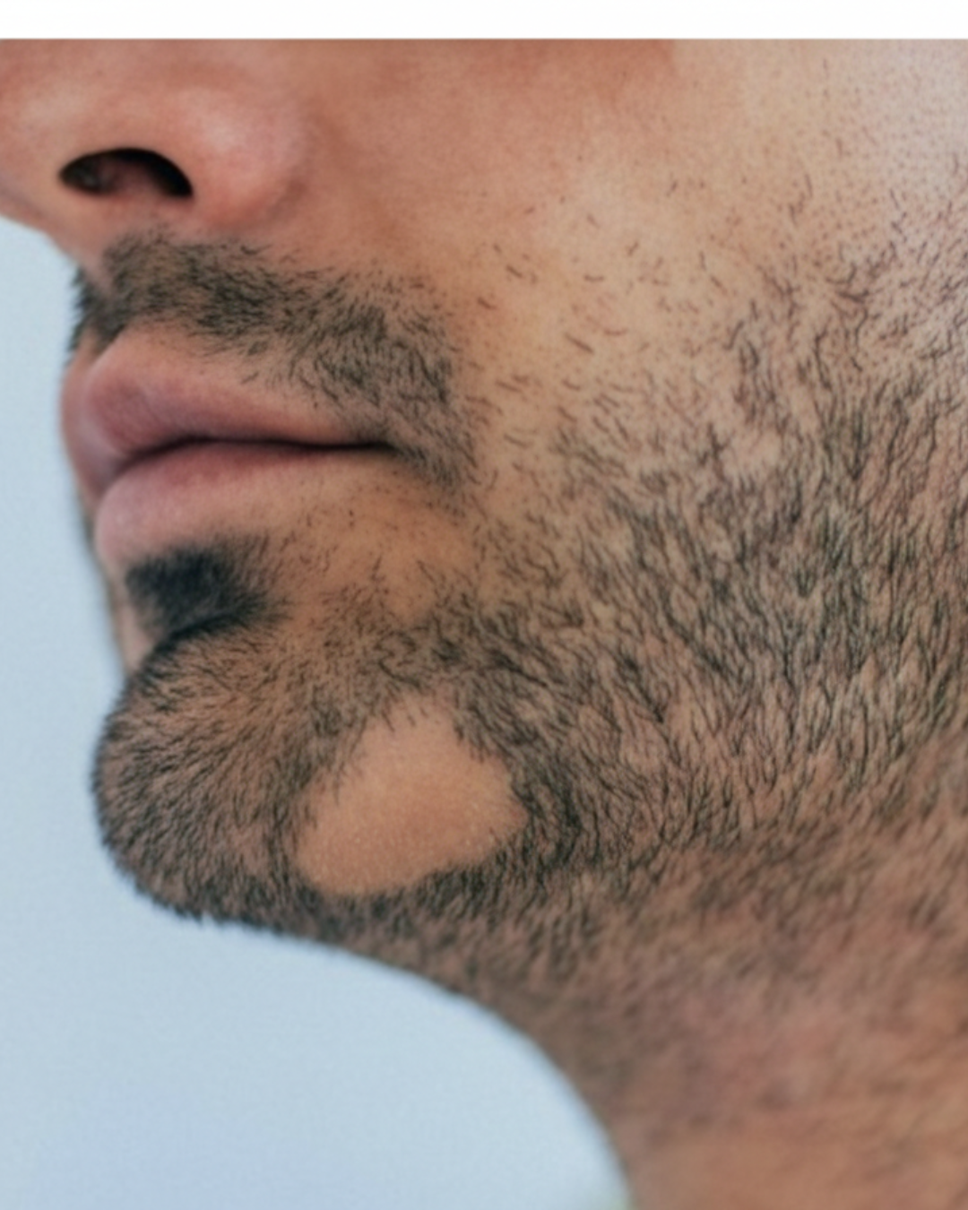 BEARD BALD SPOTS: HOW TO DISGUISE THEM WITH STYLE - Beardburys